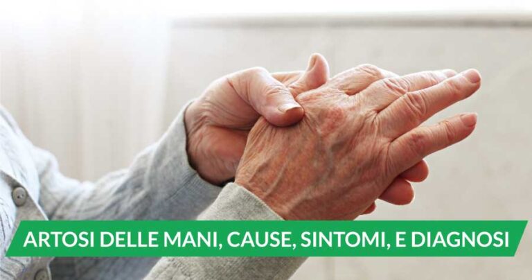 Artrosi delle Mani, cause, sintomi e diagnosi - Emicenter Artrosi delle Mani, cause, sintomi e diagnosi - Emicenter